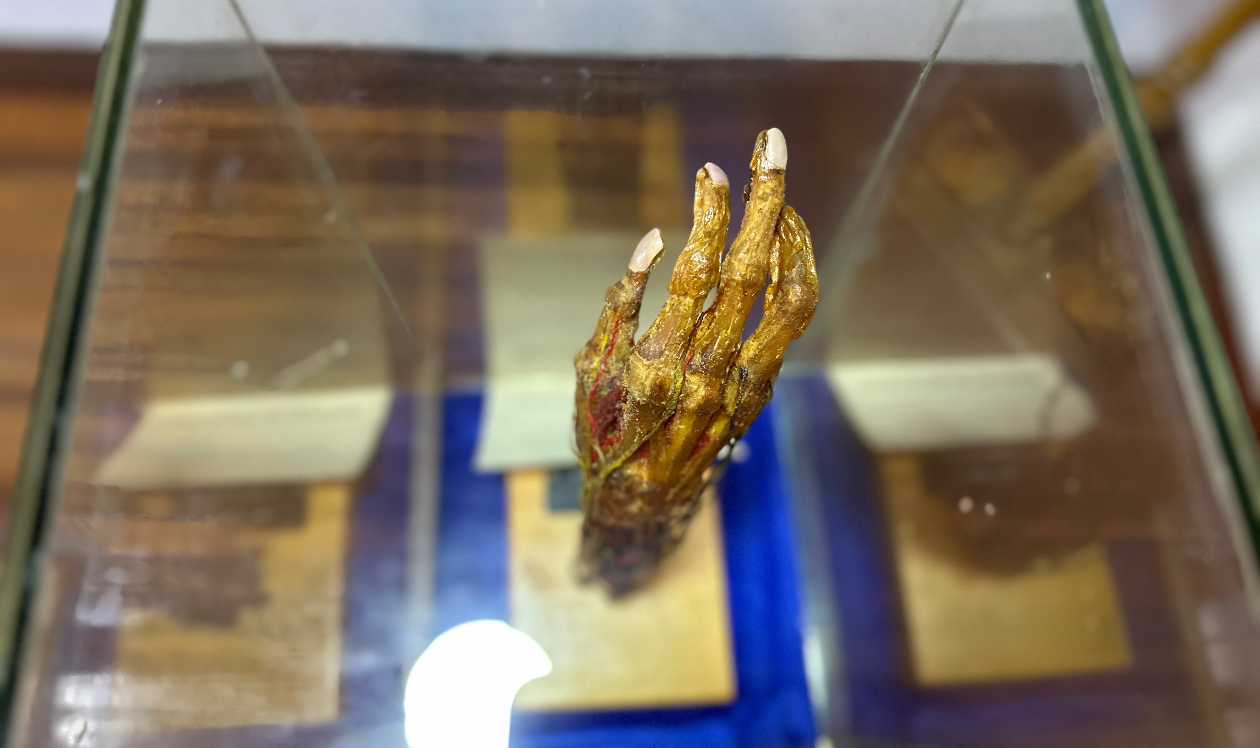 La historia del misterioso Museo del Ser Humano